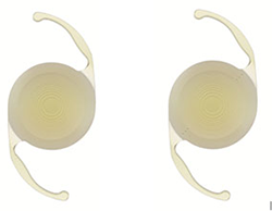 Trifocal Intraocular Lens | Professor Gus Gazzard, Consultant ...